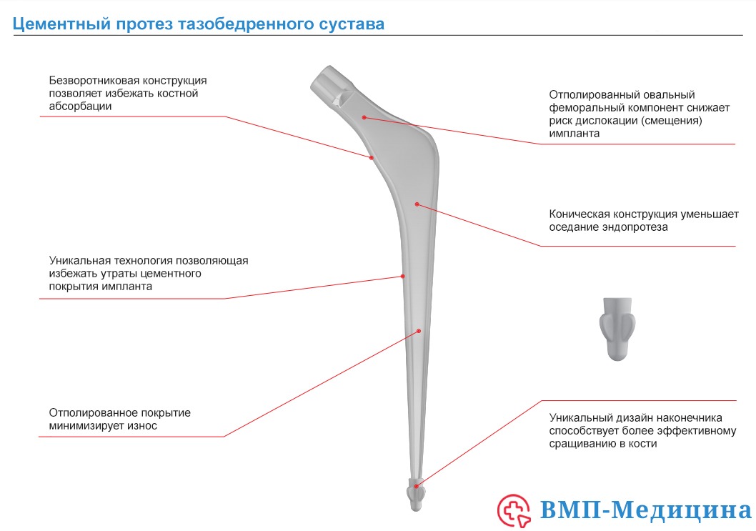 Double Medical | Double Medical импланты