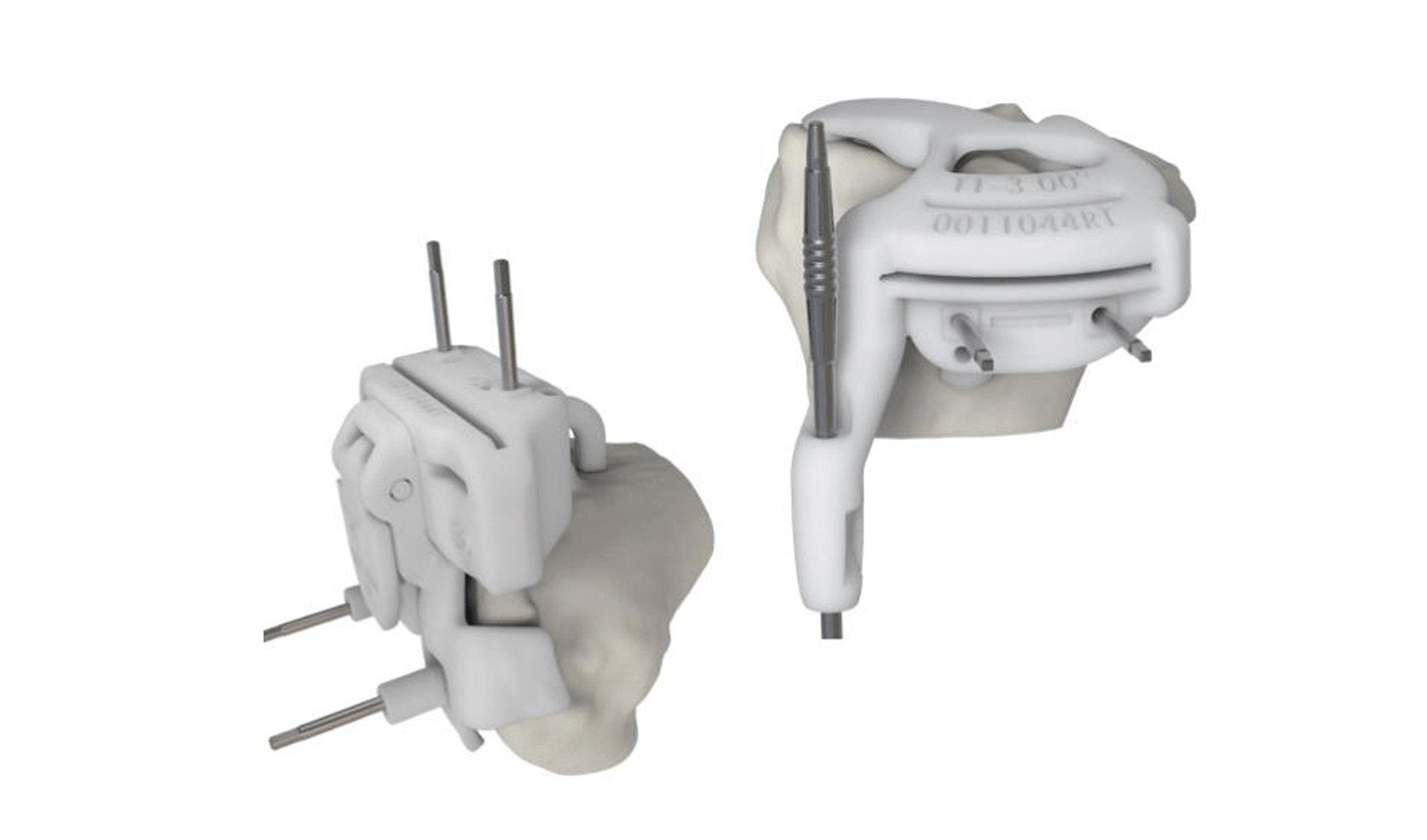 Протезы Stryker | Эндопротез тазобедренного сустава страйкер | Cтрайкер ...